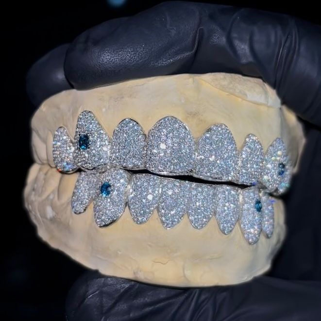 Moissanite Grillz | Custom Moissanite Diamond Grillz | CustomHipHop