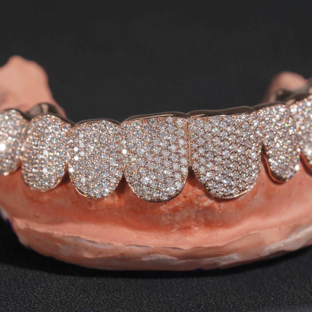 Moissanite Grillz | Custom Moissanite Diamond Grillz | CustomHipHop